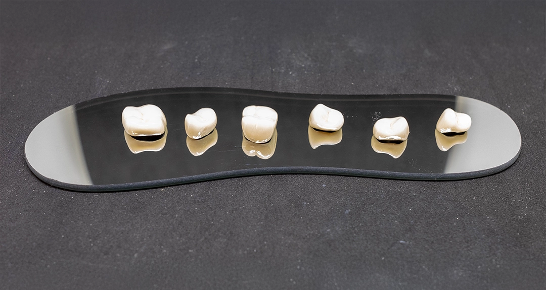 How a dental crown is givin' your choppers a rock-solid second chance ...